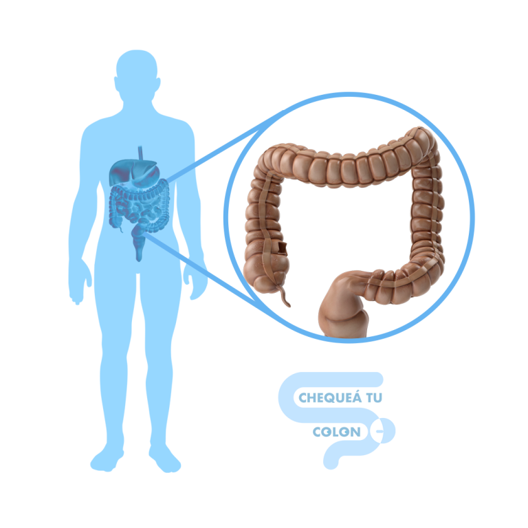 Chequeá tu Colon – Powered by CaPTyVa
