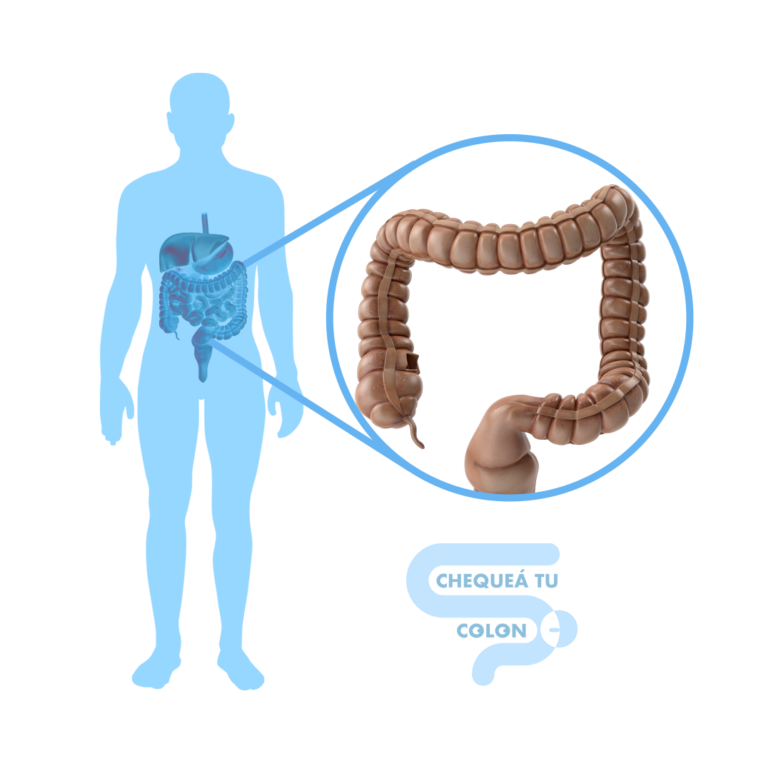 Chequeá tu Colon – Powered by CaPTyVa
