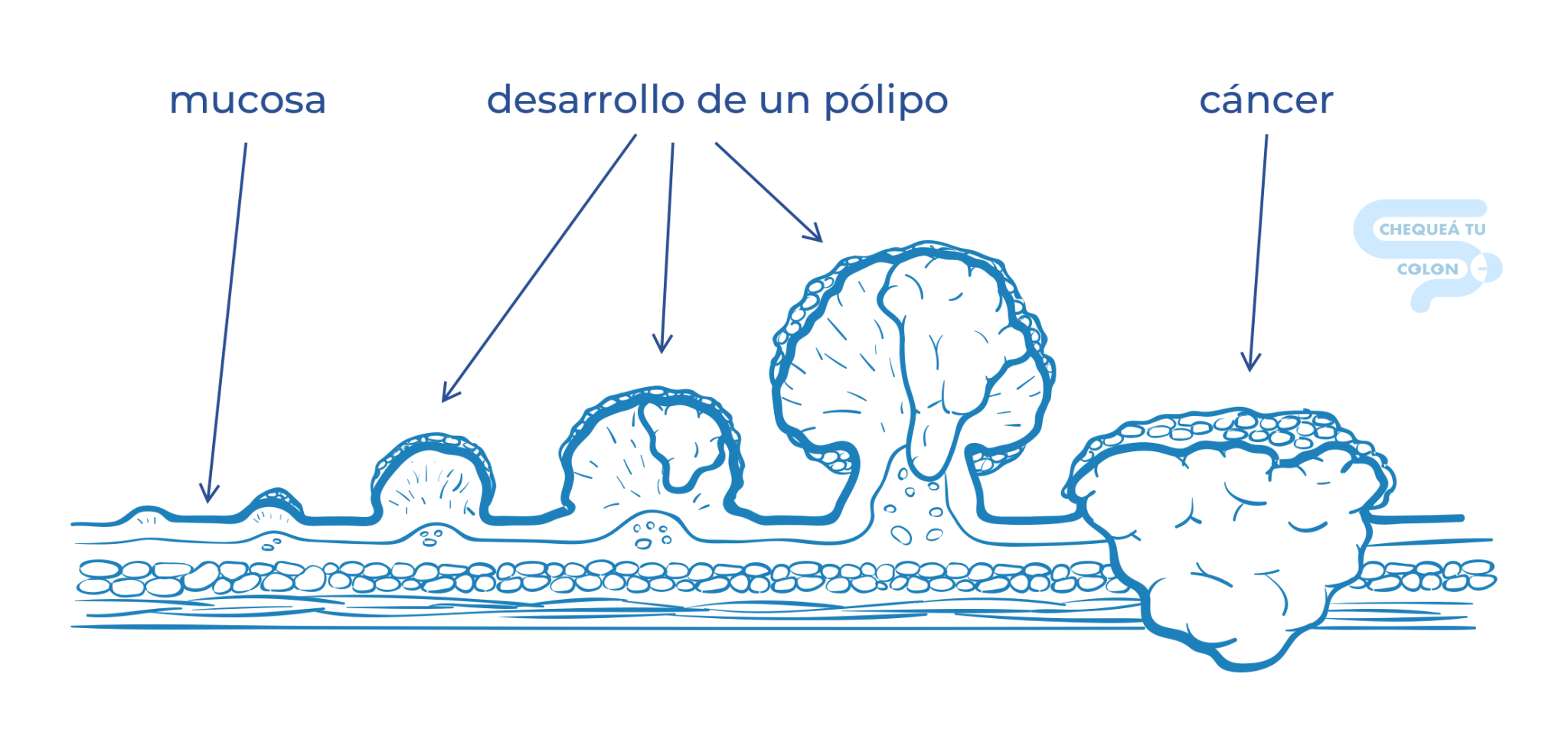 Chequeá tu Colon – Powered by CaPTyVa